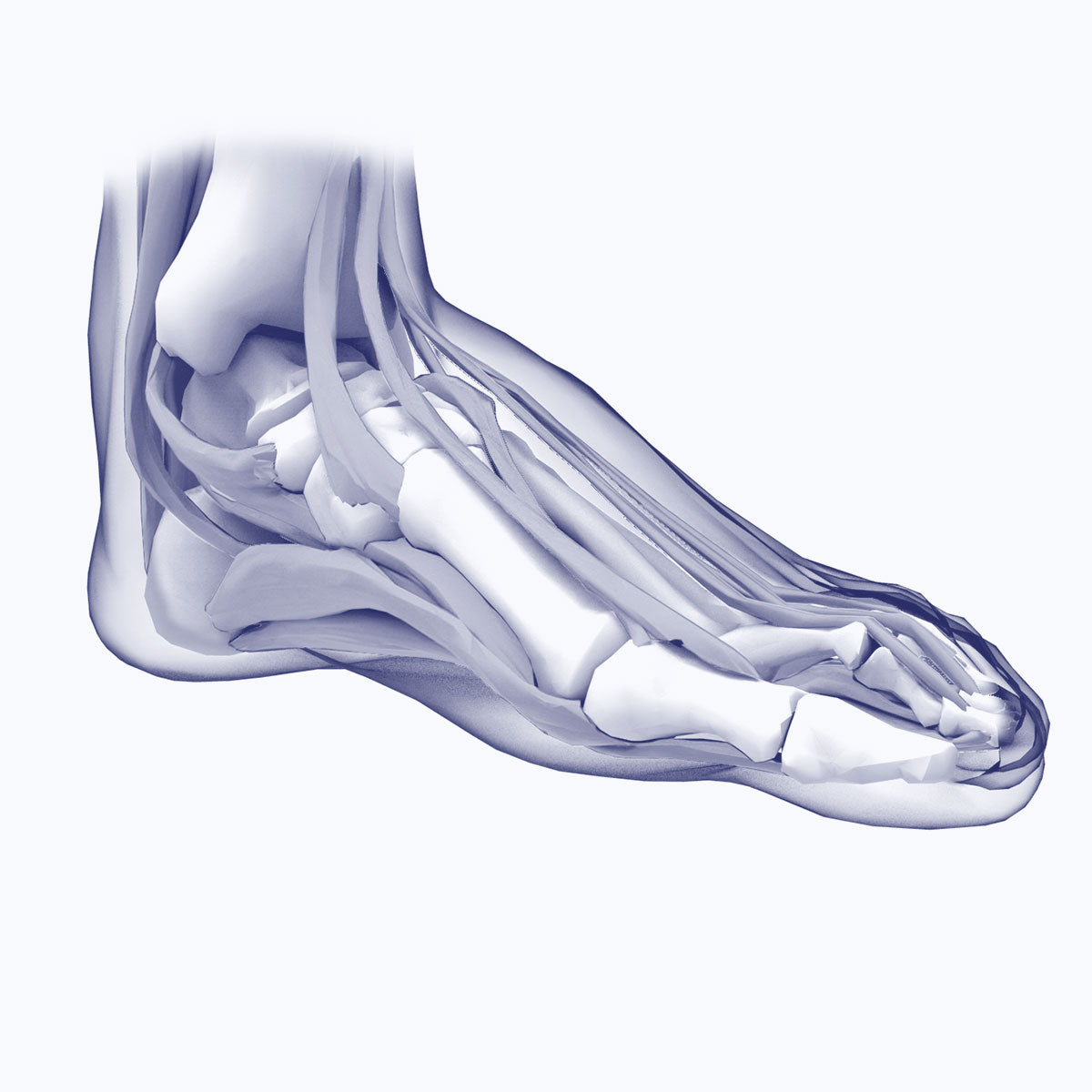 Hammer Toes - Biopods Technologies - Biopods®