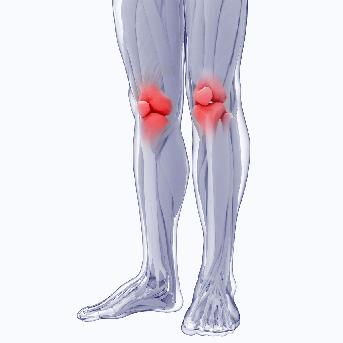 Knee Pain - Biopods Technologies - Biopods®