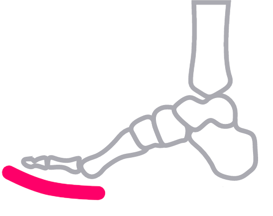 What To Expect with Stimsoles® - Biopods Insoles - Biopods®